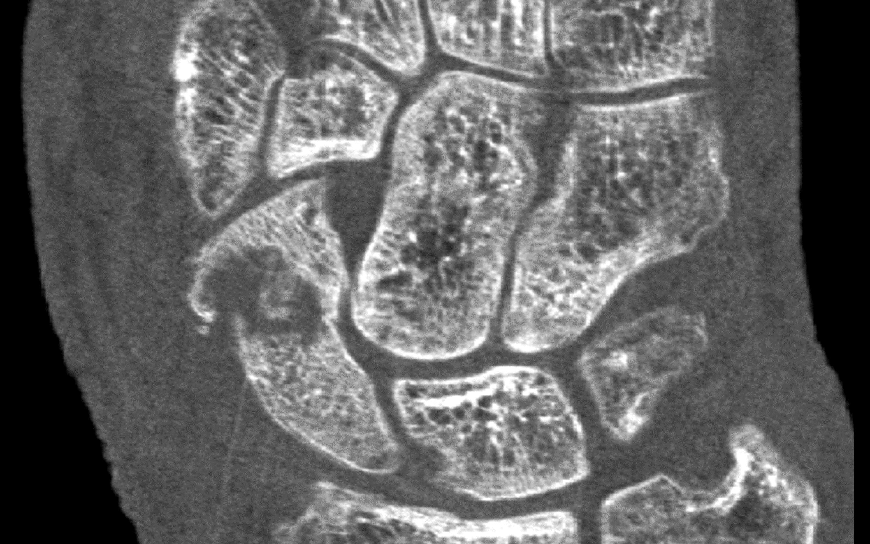 Clinical Case Studies – MARS Bioimaging