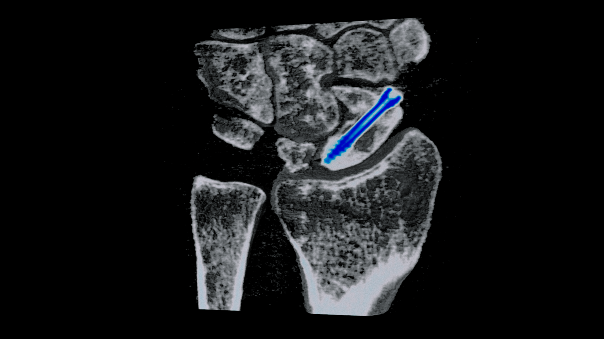 Clinical Case Studies – MARS Bioimaging